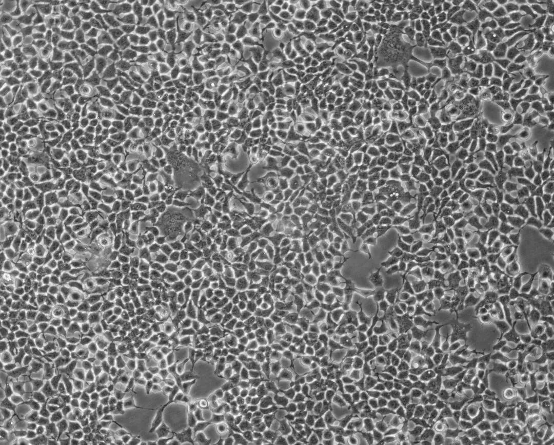细胞攻略 | 293[HEK 293](人胚肾细胞)细胞培养教程