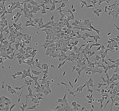NCI-H660人小细胞癌贴壁细胞系的应用