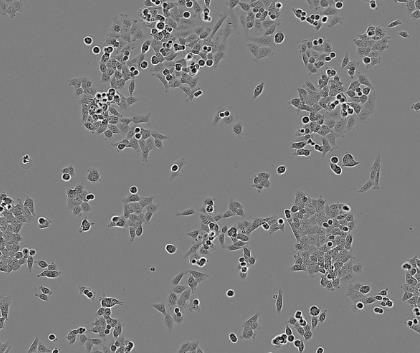 ND7/23 鼠神经母细胞瘤细胞系的应用