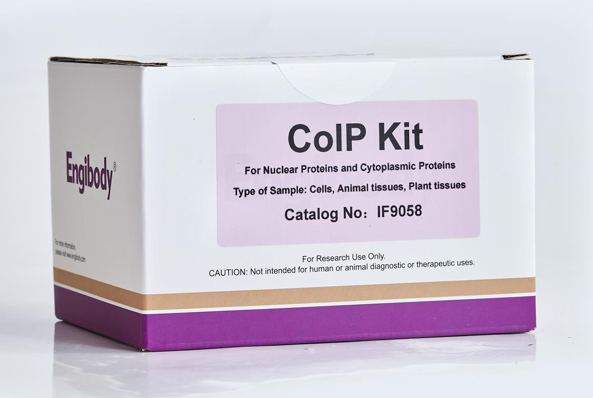 蛋白互作免疫共沉淀CoIP试剂盒 品牌:Engibody 美国 - ChemicalBook